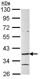 Anti-GPCR GPR4 antibody (ab97271) | Abcam