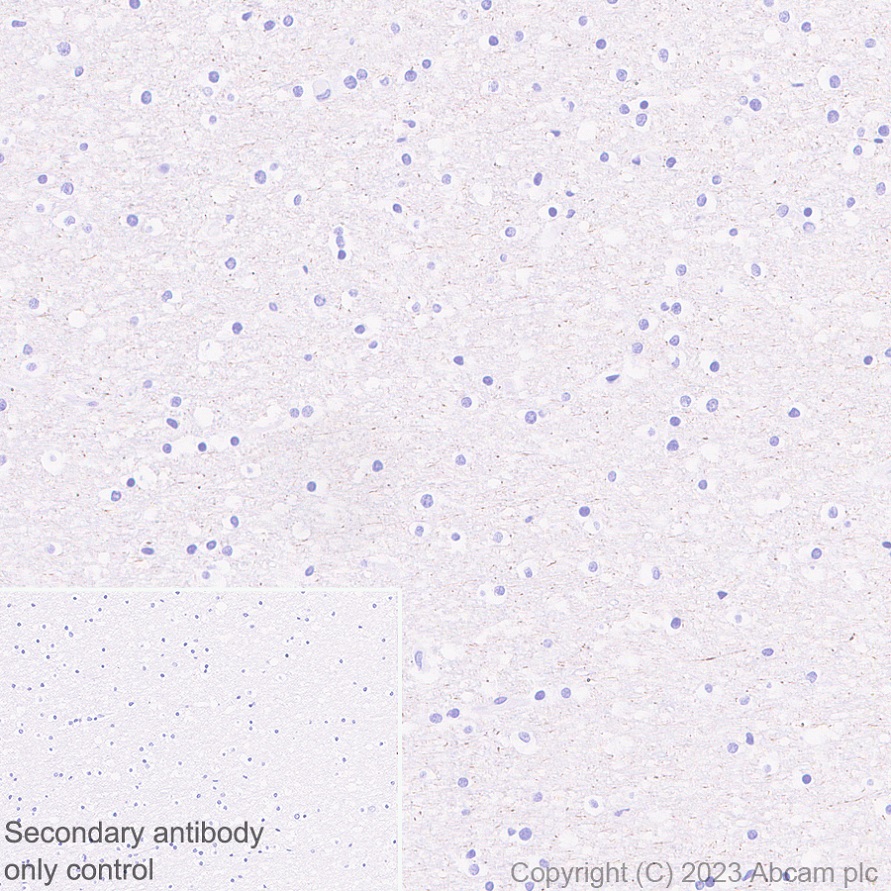 Anti-GPCR GPR52 antibody [EPR24344-51] (ab315438) | Abcam