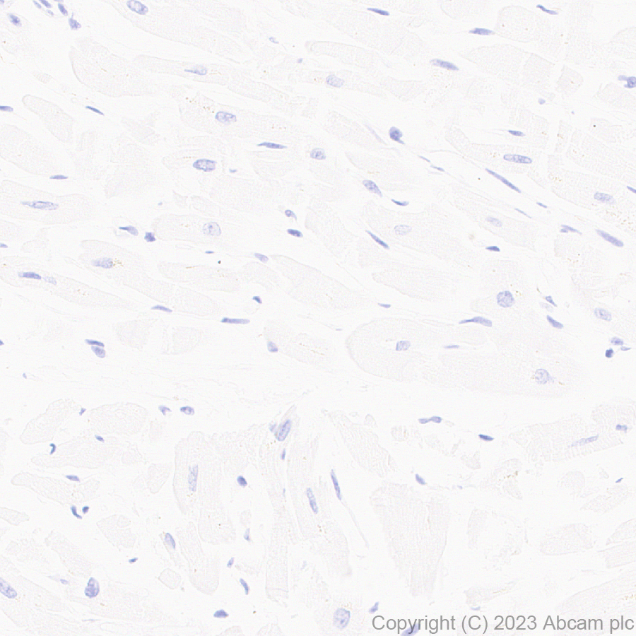Anti-GPCR GPR52 antibody [EPR24344-51] (ab315438) | Abcam