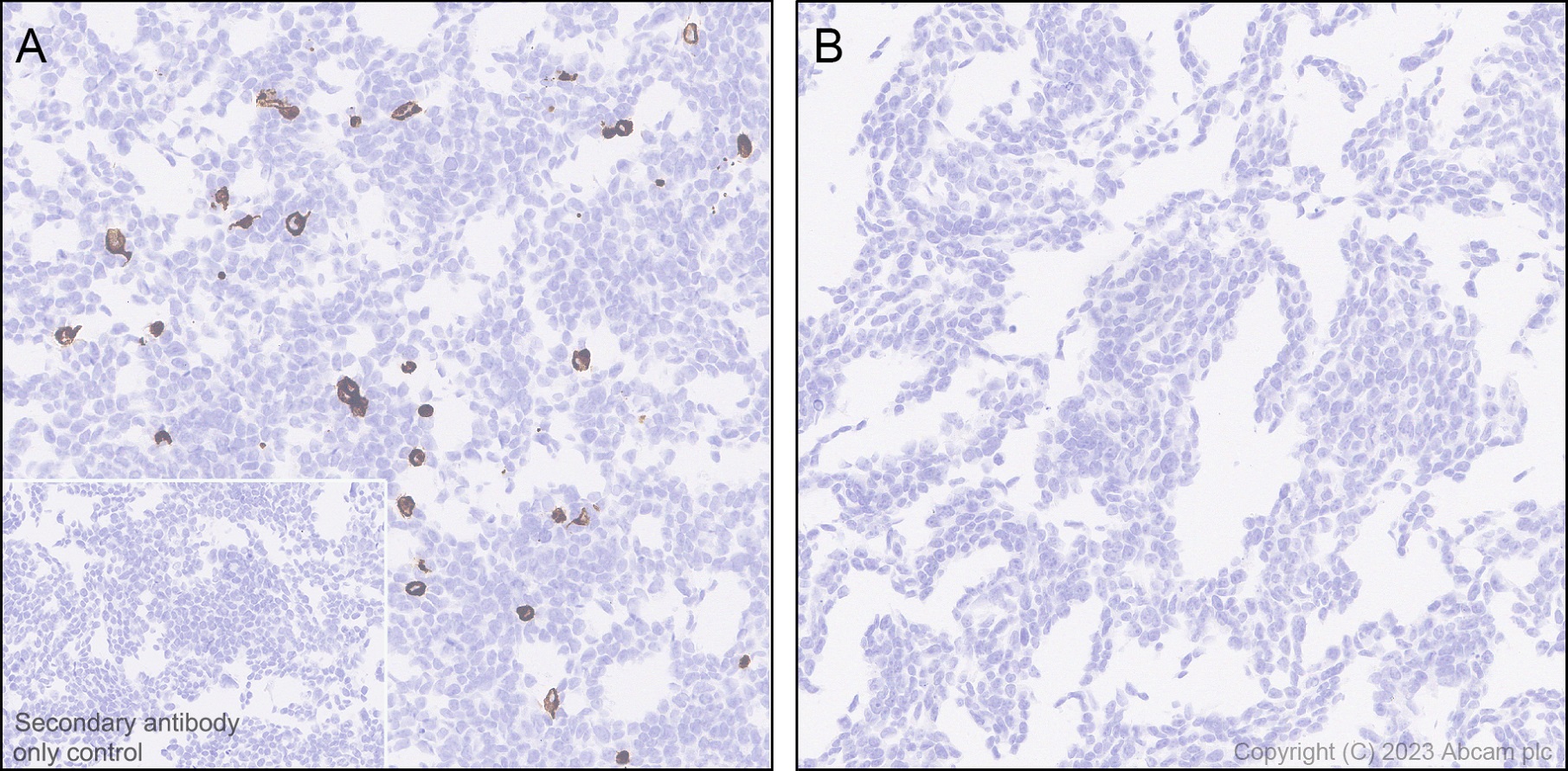 Anti-GPCR GPR52 antibody [EPR24344-51] - BSA and Azide free (ab315439 ...