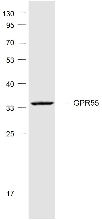 Anti-GPCR GPR55 antibody (ab203663) | Abcam