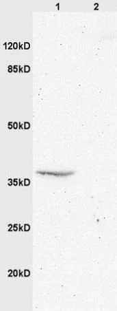 Anti-GPCR GPR55 antibody (ab203663) | Abcam
