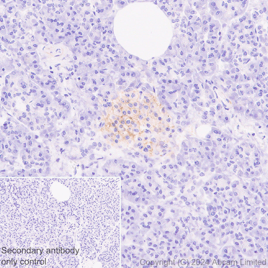 Anti-GPCR GPR75 antibody [EPR29107-69] (ab320084) | Abcam