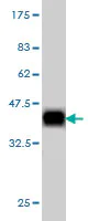 Anti-GPCR GPRC5D antibody [6D9] - Carrier free (ab55044) | Abcam