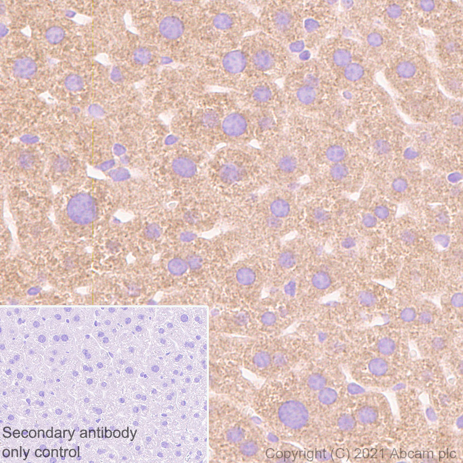 Anti-GPCR LGR6 antibody [EPR6874] (ab126747) | Abcam