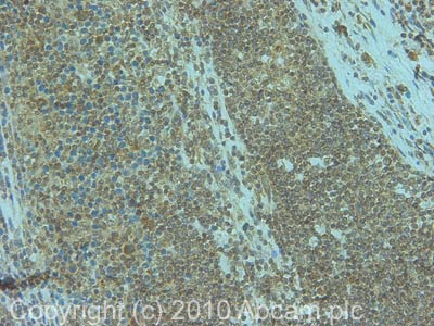 Anti-GPCR TGR5 antibody (ab72608) | Abcam