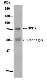 Anti-GPD2 antibody [EPR14259] - BSA and Azide free (ab240305) | Abcam