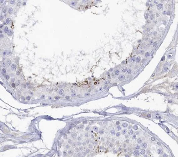 Anti-GPR123 antibody (ab122814) | Abcam