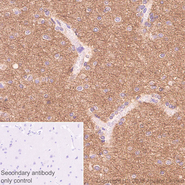 Anti-GPR37 (C terminal) antibody [EPR30352-540] (ab325132) | Abcam