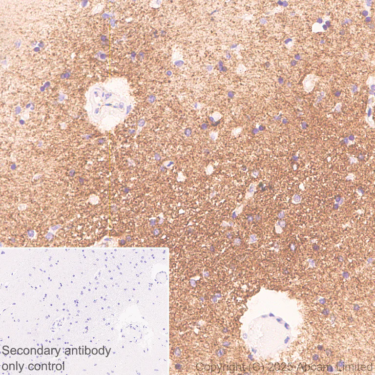 Anti-GPR37 (C terminal) antibody [EPR30352-540] (ab325132) | Abcam