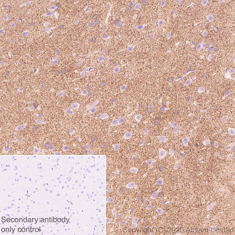 Anti-GPR37 (C terminal) antibody [EPR30352-540] (ab325132) | Abcam