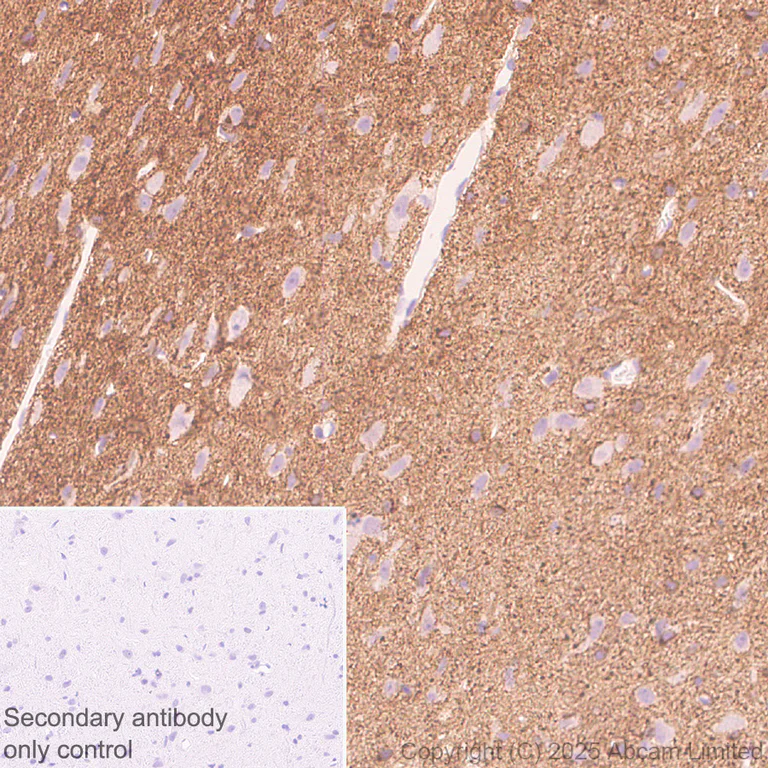 Anti-GPR37 (C terminal) antibody [EPR30352-540] (ab325132) | Abcam
