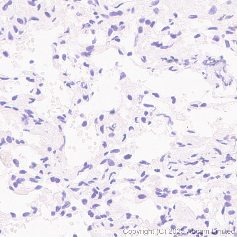 Anti-GPR37 (C terminal) antibody [EPR30352-540] (ab325132) | Abcam