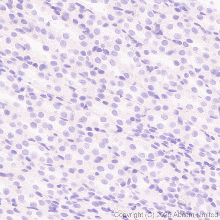 Anti-GPR37 (C terminal) antibody [EPR30352-540] (ab325132) | Abcam