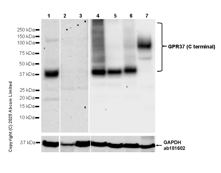 Anti-GPR37 (C terminal) antibody [EPR30352-540] (ab325132) | Abcam