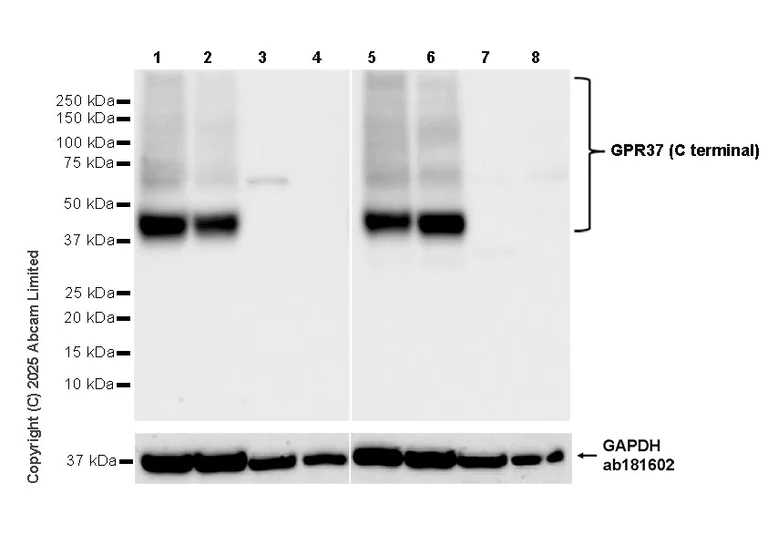 Anti-GPR37 (C terminal) antibody [EPR30352-540] (ab325132) | Abcam