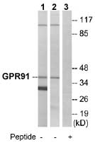 GPR91抗体- Cytoplasmic domain (ab140795)| Abcam中文官网