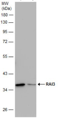 Anti-GPRC5A antibody (ab155557) | Abcam