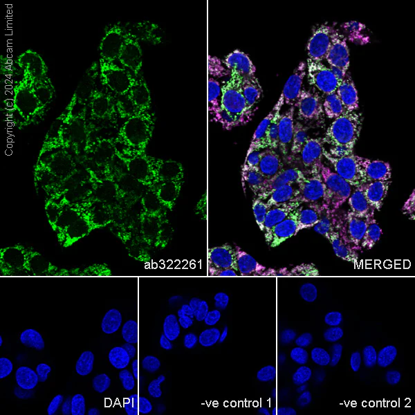 Anti-GPT2 antibody [EPR29176-18] (ab322261) | Abcam