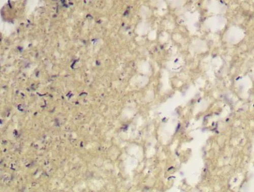 Gram Stain Kit (Microorganism Stain) (ab150672) | Abcam