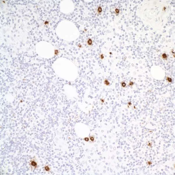Granzyme B Antibody Panel (EPR8260, EPR20129-217, BLR022E) Recombinant ...