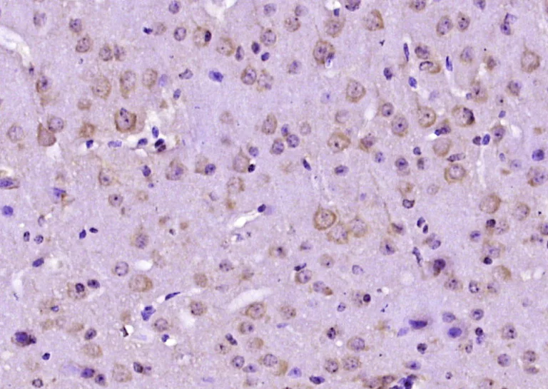 Anti-GRB10 + GRB14 Antibody (ab317371) | Abcam