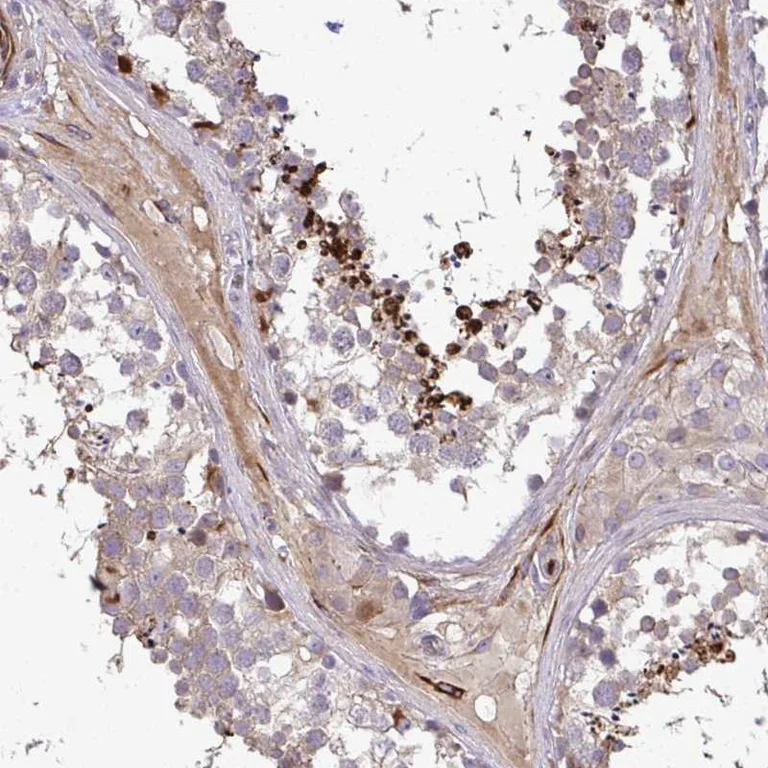 Anti-GRID2 antibody (ab251953) | Abcam