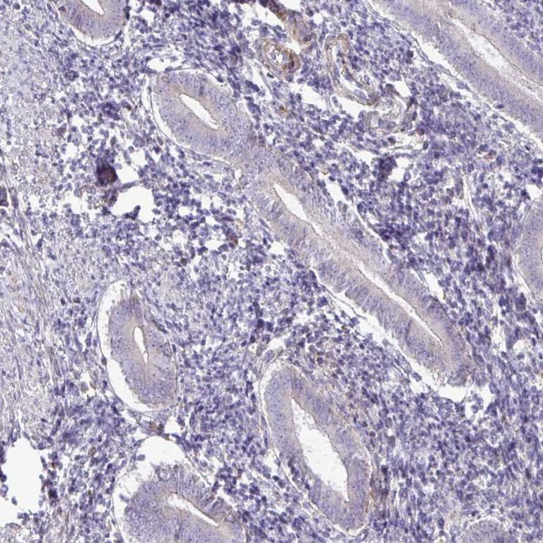 Anti-GRID2 antibody (ab251953) | Abcam