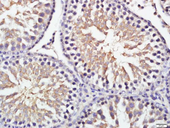 GRINA抗体 (ab216953)| Abcam中文官网