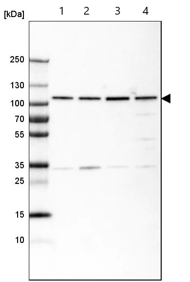 Anti-GRP94 antibody [CL2647] - C-terminal (ab210960) | Abcam