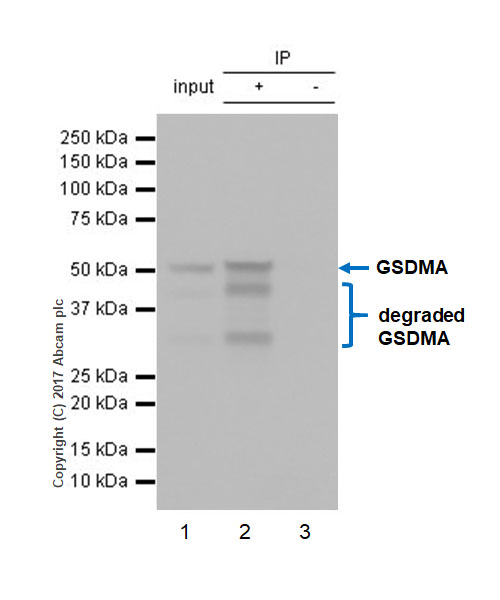 Anti-GSDMA antibody [EPR19858-104] Rabbit monoclonal (ab230768) | Abcam