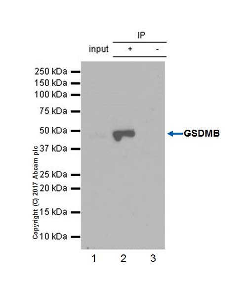Anti-GSDMB antibody [EPR20841] Rabbit monoclonal (ab215729) | Abcam