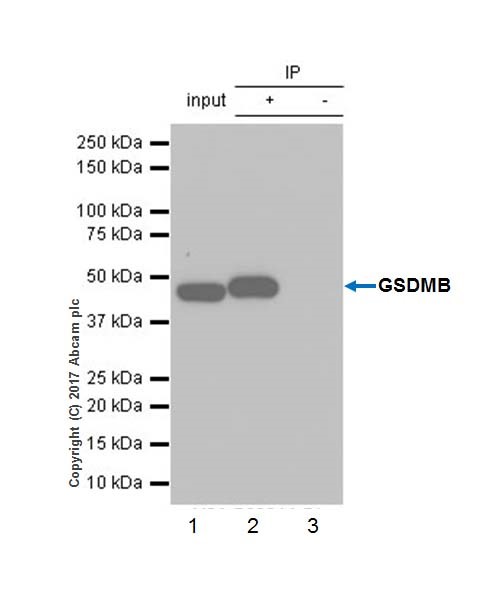 Anti-GSDMB antibody [EPR20841] (ab215729) | Abcam