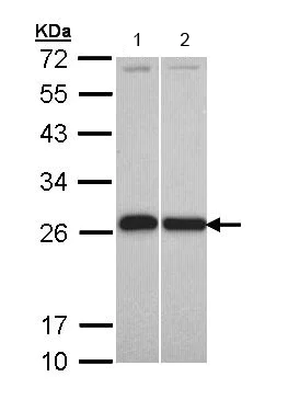 Anti-GST3 / GST pi antibody (ab153949) | Abcam