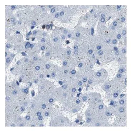 Anti-GST3 / GST pi antibody (ab259373) | Abcam
