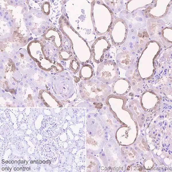 Anti-GST3 / GST pi antibody [EPR20554] - BSA and Azide free (ab242014 ...