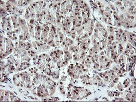 Anti-H-protein antibody [OTI3G1] (ab156763) | Abcam