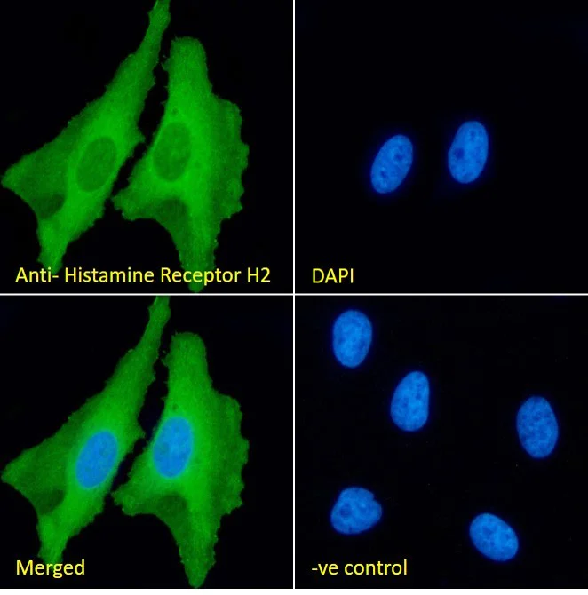 H2R抗体 (ab39964)| Abcam中文官网