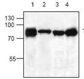 Anti-HADHA antibody (ab54477) | Abcam