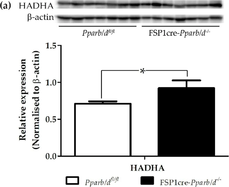 Anti-HADHA antibody [EPR17940] Rabbit monoclonal (ab203114) | Abcam