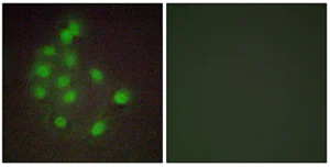 Anti-HAND1 antibody (ab196622) | Abcam