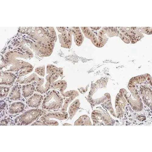 Anti-HAX1 antibody [HL2170] (ab317151) | Abcam