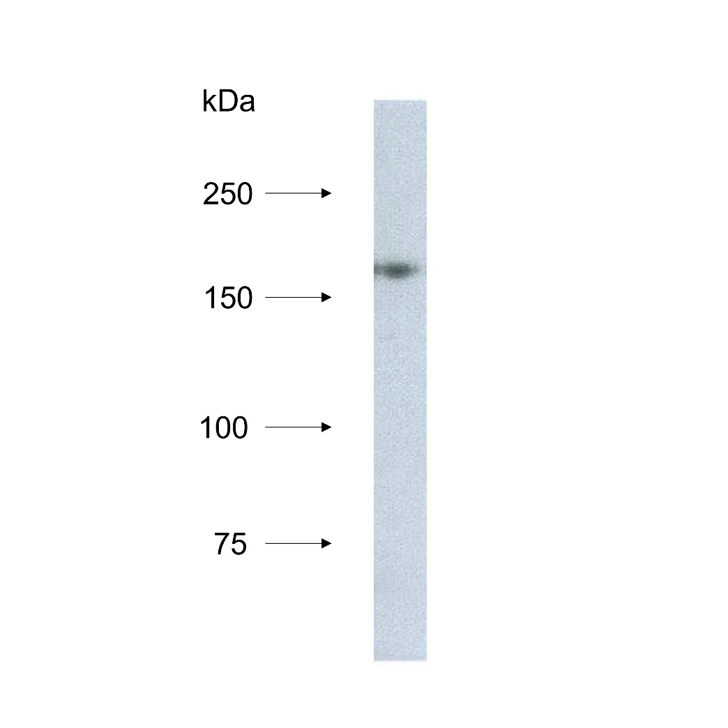Anti-hCAP-D3 Antibody [2B5] (ab316348) | Abcam