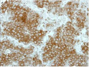 Anti-HCF-1 / Host Cell Factor C1 antibody - N-terminal (ab137618) | Abcam