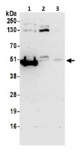 Anti-HCP1/PCFT antibody (ab241949) | Abcam