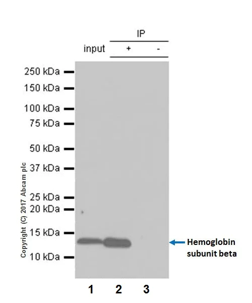 Hemoglobin subunit beta抗体[EPR20614] (ab214049)| Abcam中文官网