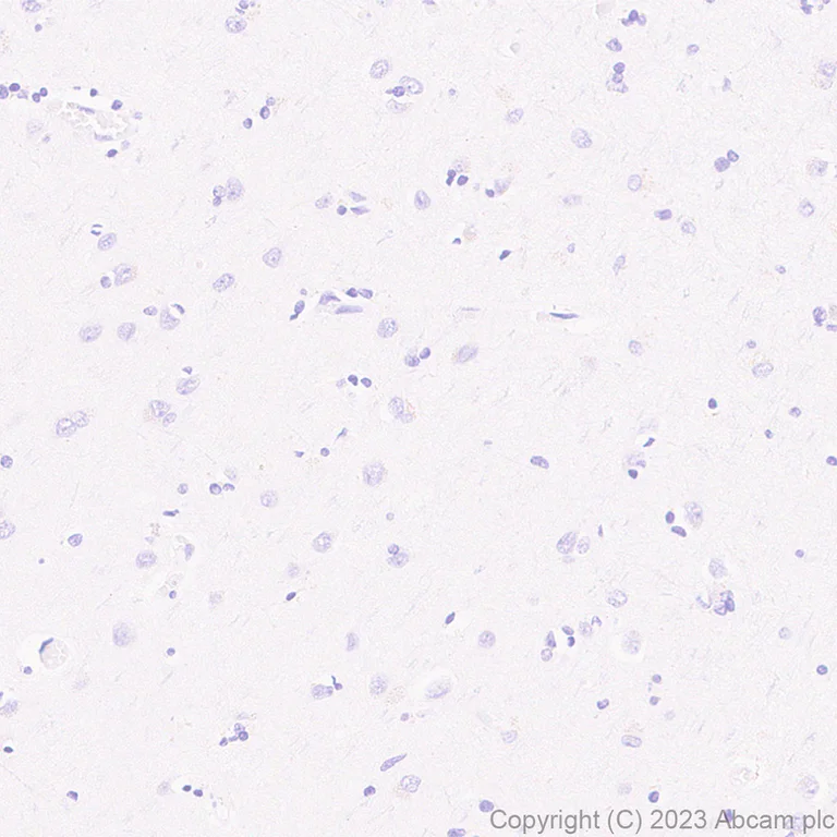 Hepatitis B Virus Core Antigen抗体[EPR28251-34] - BSA and Azide free ...
