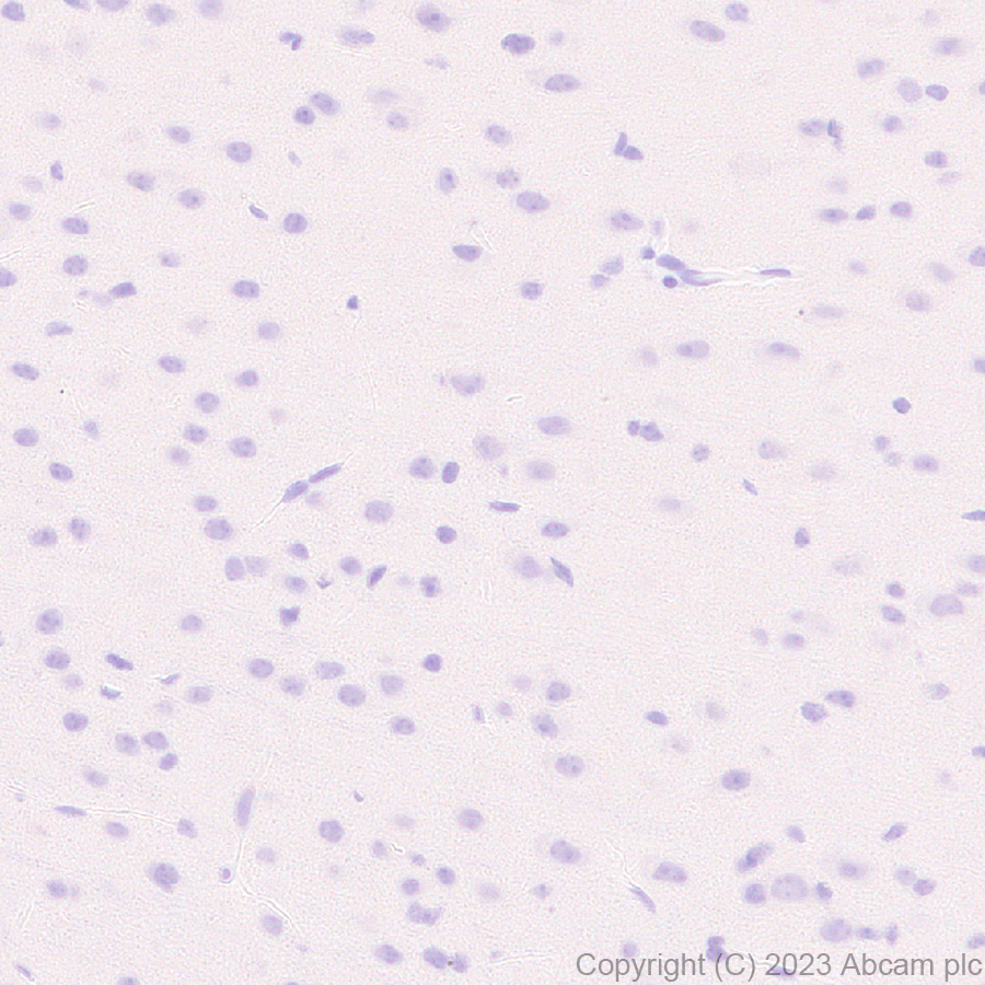 Anti-Hepatitis B Virus Core Antigen antibody [EPR28251-34] - BSA and ...