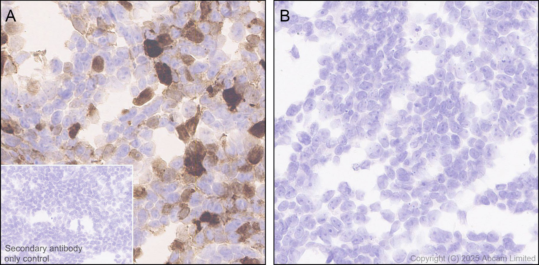 Anti-Hepatitis B Virus Core Antigen antibody [EPR29890-38] (ab323646 ...