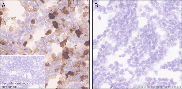 Anti-Hepatitis B Virus Core Antigen antibody [EPR29890-38] (ab323646 ...